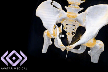 Avatar Medical, comment les avatars virtuels gagnent le bloc opératoire ...